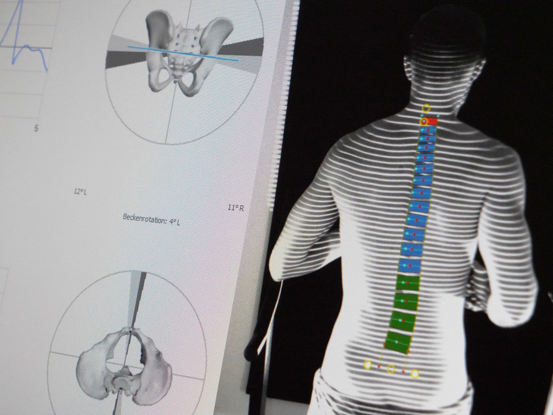 Area Scan Cameras | high-performance CMOS cameras | IDS